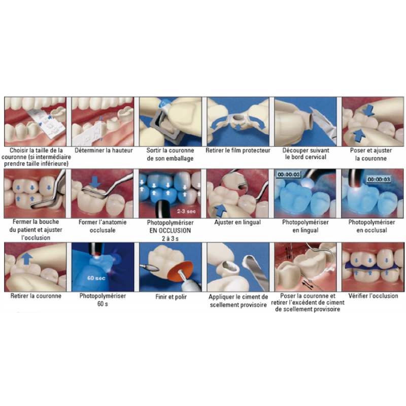 PROTEMP CROWN KIT D'ESSAI