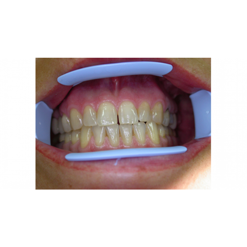 OPTIVIEW KIT ASSORTI