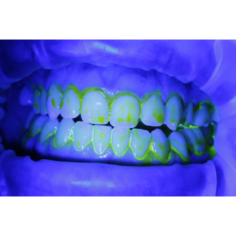 PLAQUE TEST FLACON 11 GR.