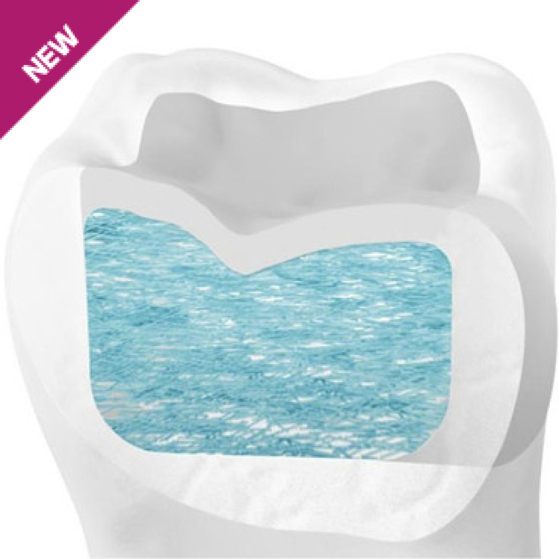 EVER X POSTERIOR CAPS